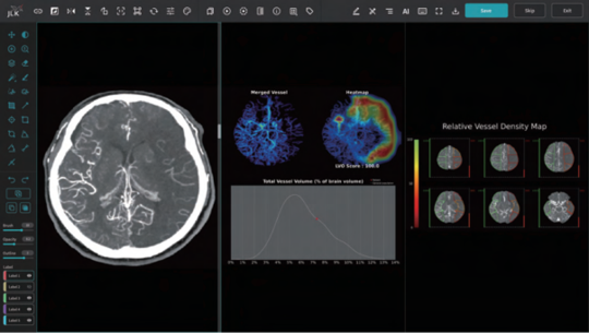JLK, 美 하버드 JBS-LVO 임상 기반으로 올해 1분기 내 FDA 허가 신청